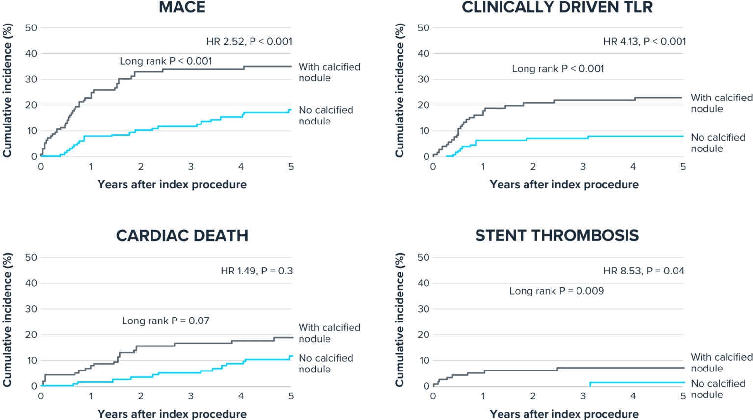 IVL & Nodular Calcium - Shockwave Medical