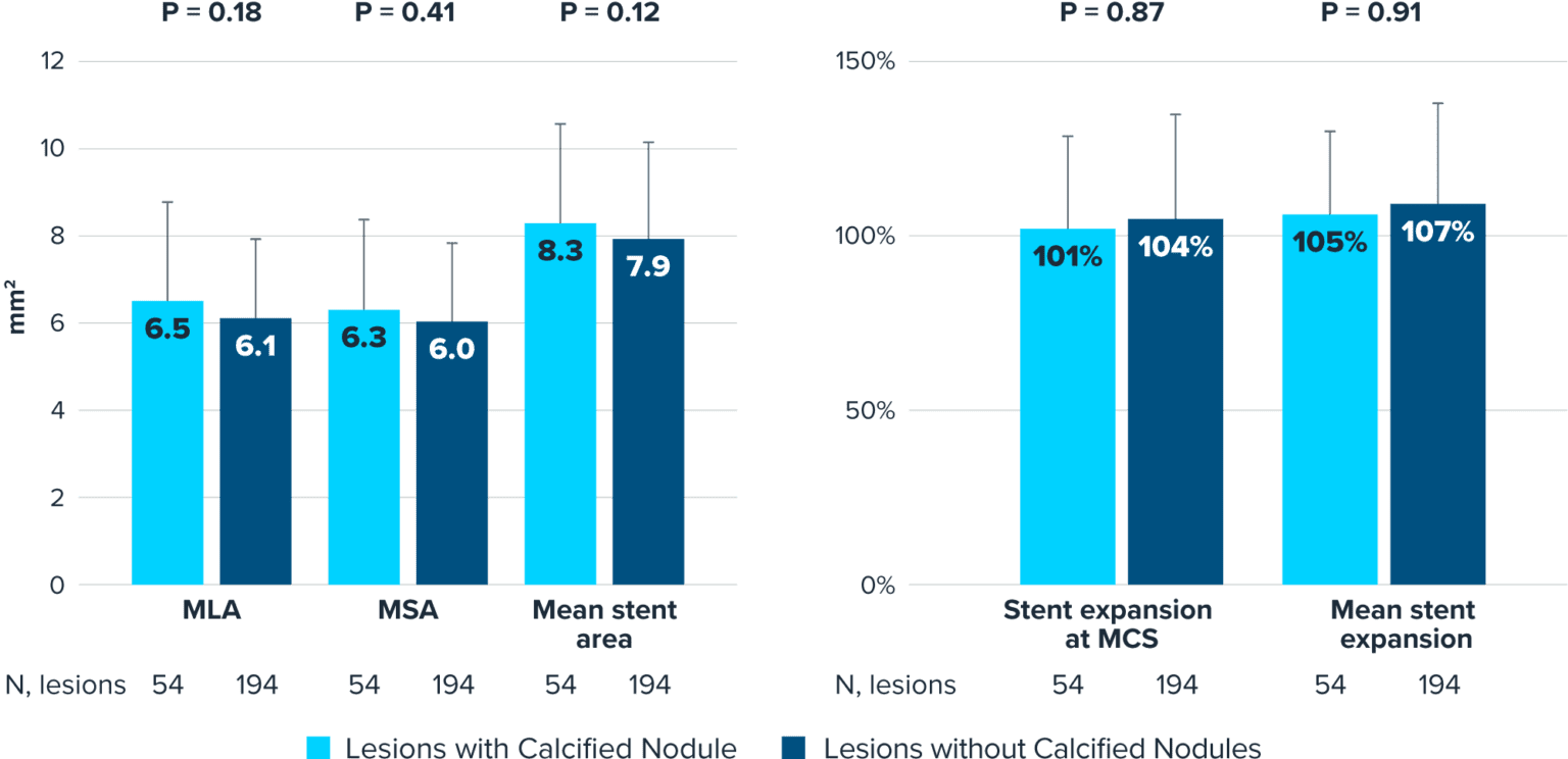 IVL & Nodular Calcium - Shockwave Medical