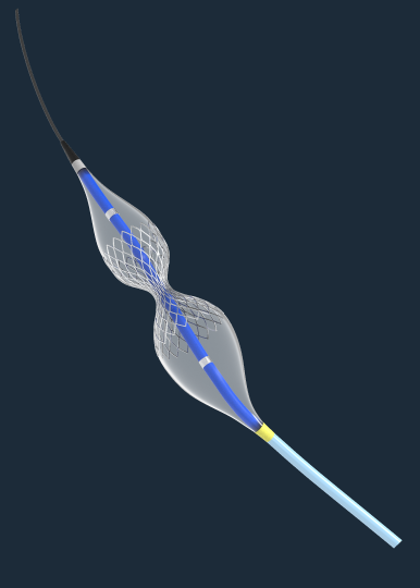 COSIRA II Symposium: Angina: The Scope Of The Challenge - Shockwave Medical