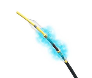 Shockwave Reducer - Shockwave Medical