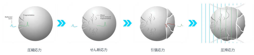 IVL Overview And MOA - Shockwave Medical