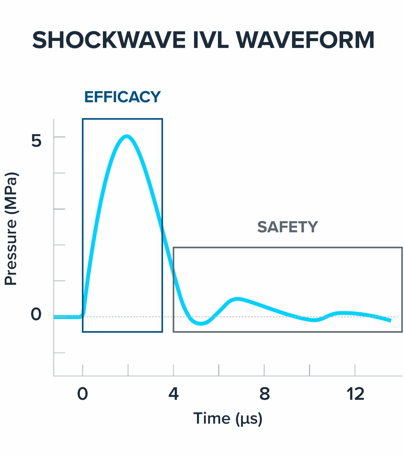 IVL Overview And MOA - Shockwave Medical
