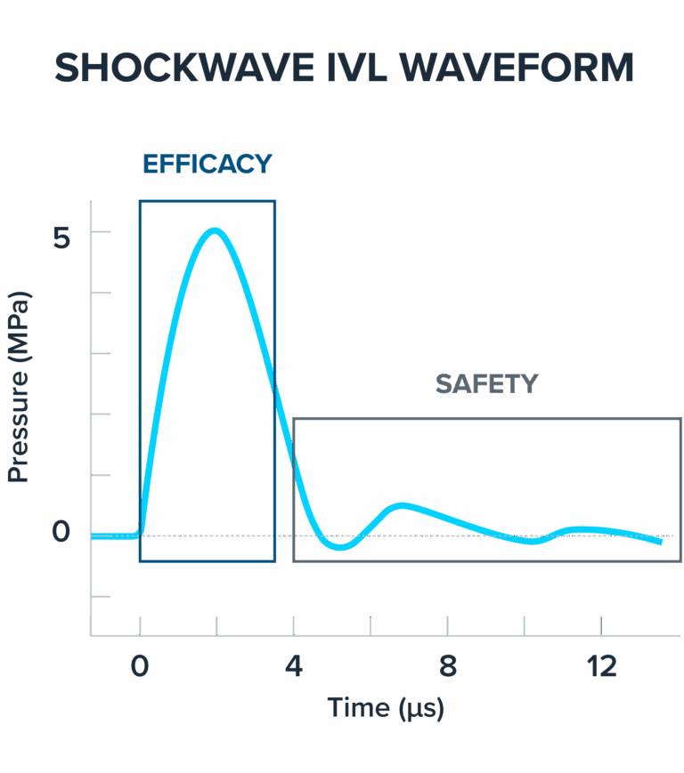 IVL Overview And MOA - Shockwave Medical
