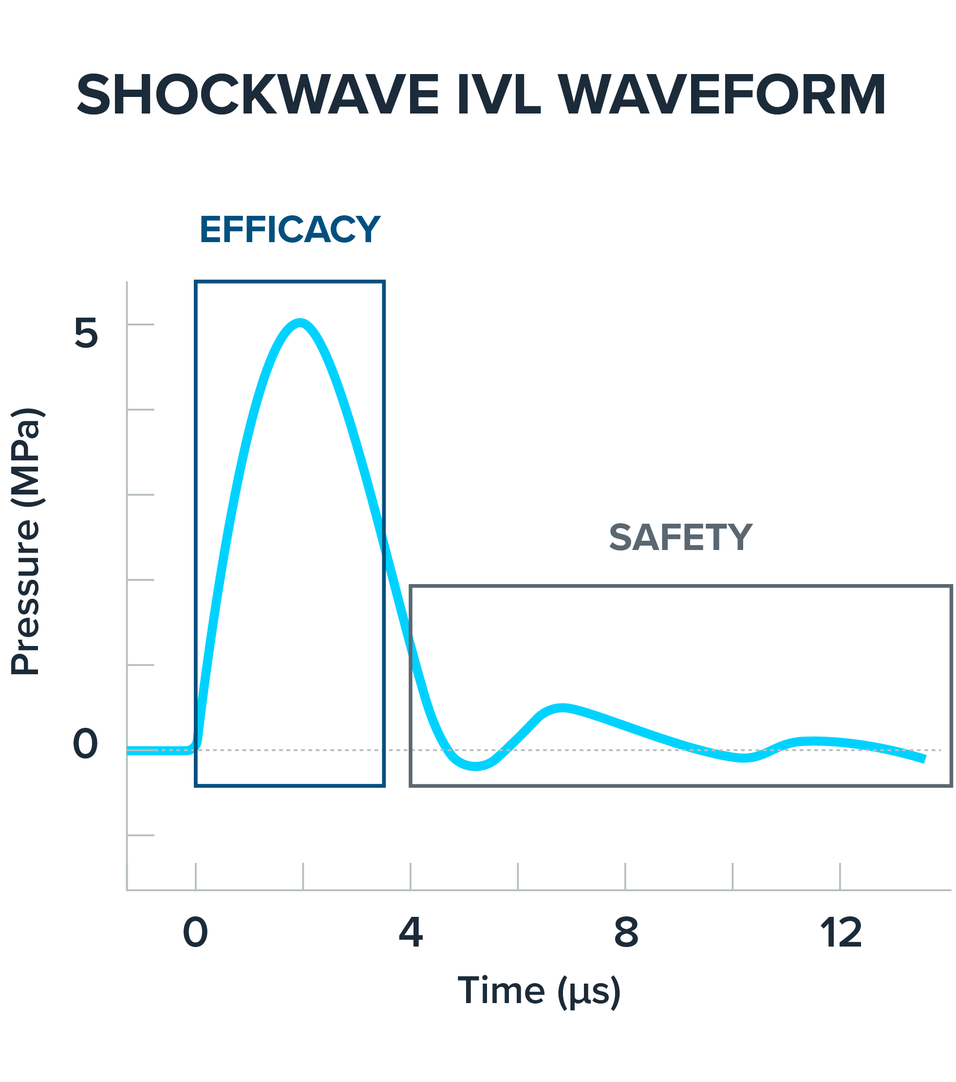 IVL Overview And MOA - Shockwave Medical